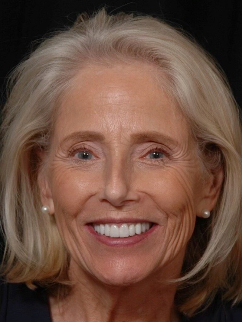 Joan F. Roth - West Central Tribune | News, weather, sports from ...