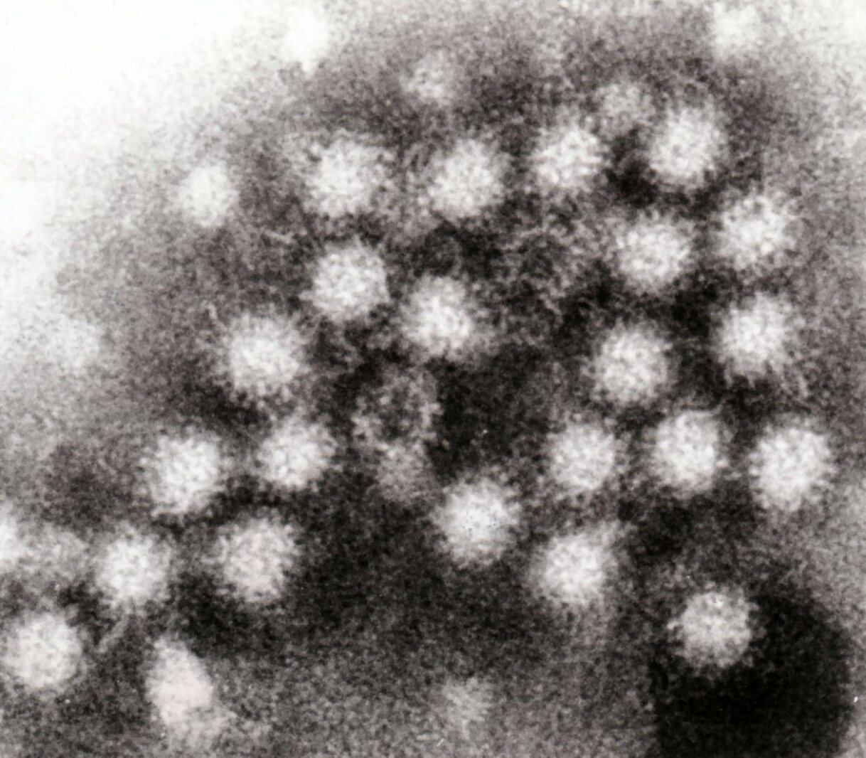 New strain of norovirus could be driving outbreaks - Superior Telegram ... New strain of norovirus could be driving outbreaks - Superior Telegram ...